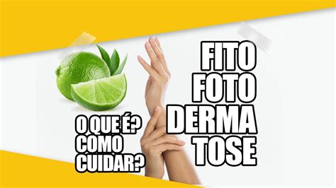 Fitofotodermatose O Que é Como Cuidar Youtube