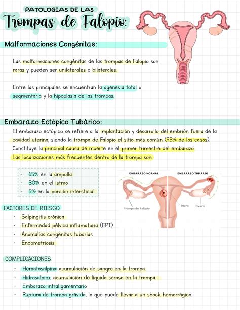 Embarazo En Las Trompas De Falopio