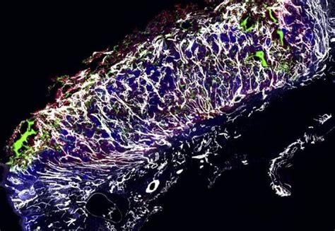 Serena Zacchigna Posted On Linkedin