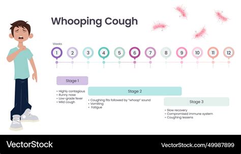Whooping Cough Pertussis Symptom Timeline Vector Image