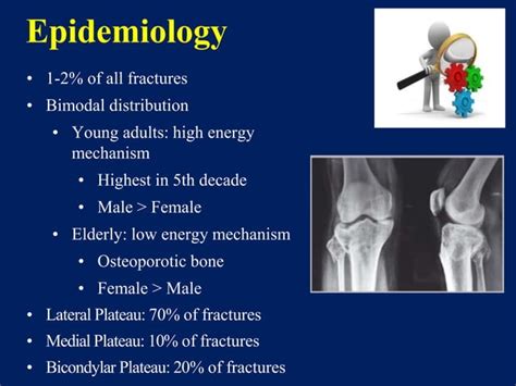 Proximal Tibia Fractures And Its Management Pptx
