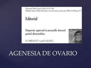 Agenesia De Ovario Ppsx
