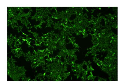 Indirect Immunofluorescence Microscopy Of Hek293 Cells That Download Scientific Diagram