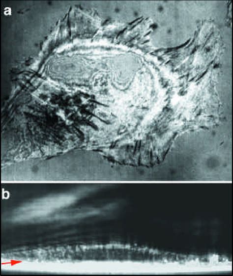 Figure 2 From Confocal Reflection Microscopy The Other Confocal Mode Semantic Scholar