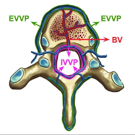 Diagram Illustrating The Vertebral Venous Plexus In The Sagittal Plane Diagram Illustrating The Vertebral Venous Plexus In The Sagittal Plane