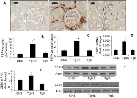 Sirolimus Attenuates Renal Cell Fsp1 Expression In Hivan Mice Download Scientific Diagram