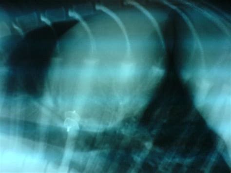 Occluder In A Pda Veteirnary Surgical Nursing Gallery Clinical