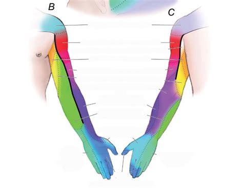 Rehab 544 Upper Extremity Peripheral Nerve Innervation Patterns