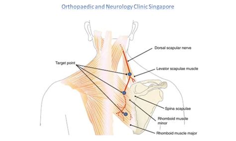 Rhomboid Pain Solution 菱形痛 Essential Back Muscle Clinic