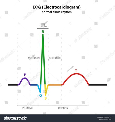 Electrocardiogram Ecg Ekg Normal Sinus Rhythm Stock Vector Royalty