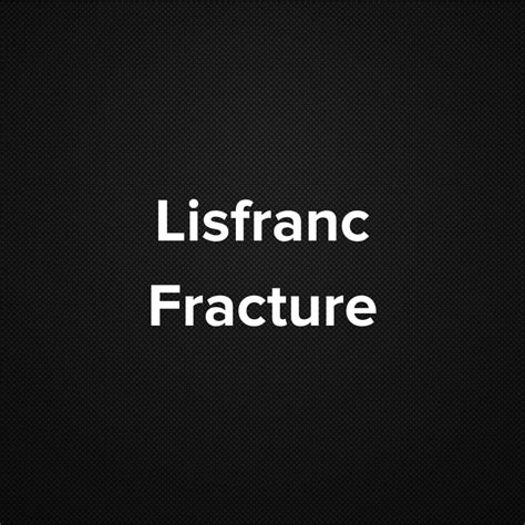 Lisfranc Fracture Moho