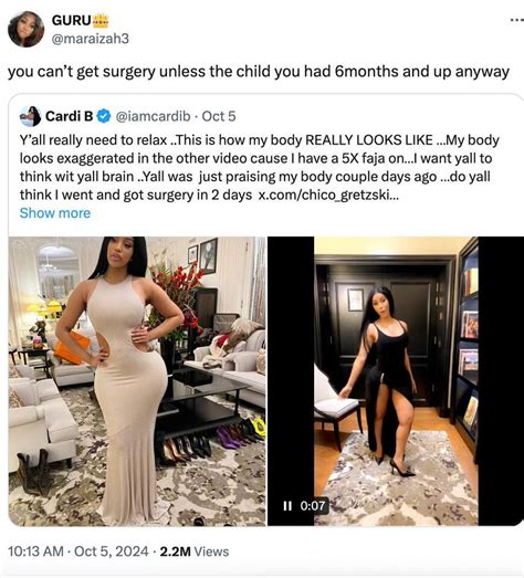 Cardi B Responds To Plastic Surgery Claims After Giving Birth To Her