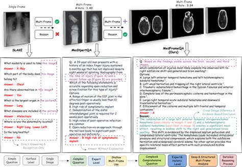 논문 리뷰 Medframeqa A Multi Image Medical Vqa Benchmark For Clinical Reasoning