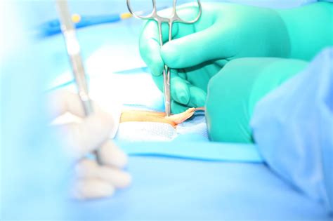 Ercp Nedir Doktor Amcam