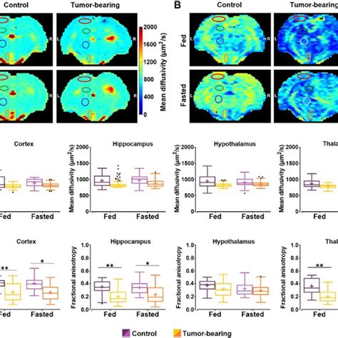 Mean Diffusivity And Fractional Anisotropy In The Brain Of Control And