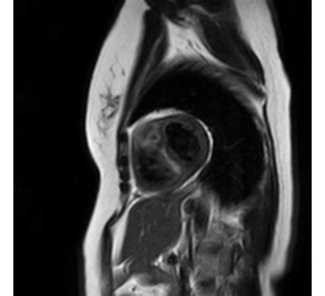 8 F5 B35 Cc 02 B3 4535 Ad8 B 12 E8 Bb3 Cb3 A5 — Postimages