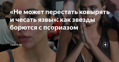 «Не может перестать ковырять и чесать язвы как звезды борются с
