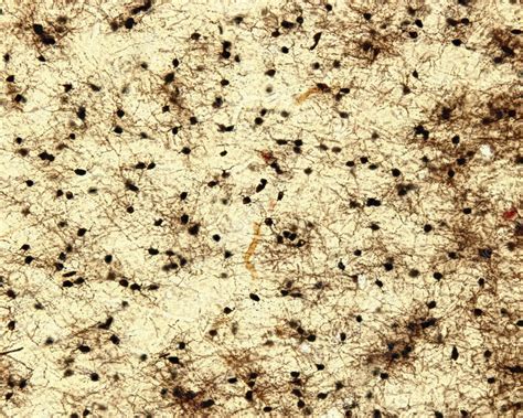 Oligodendrocytes Light Micrograph Stock Image C0599311 Science