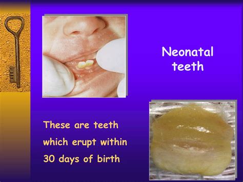 Natal Neonatal Teeth Pedo Ppt