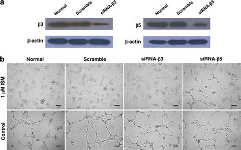 Ism Inhibits In Vitro Angiogenesis Through αvβ5 Integrin A Transient Download Scientific