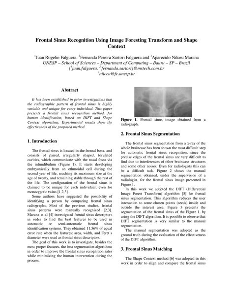 Pdf Frontal Sinus Recognition Using Image Foresting Transform And Shape Context