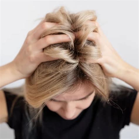 5 Side Effects Of Bleaching Your Hair Reademall