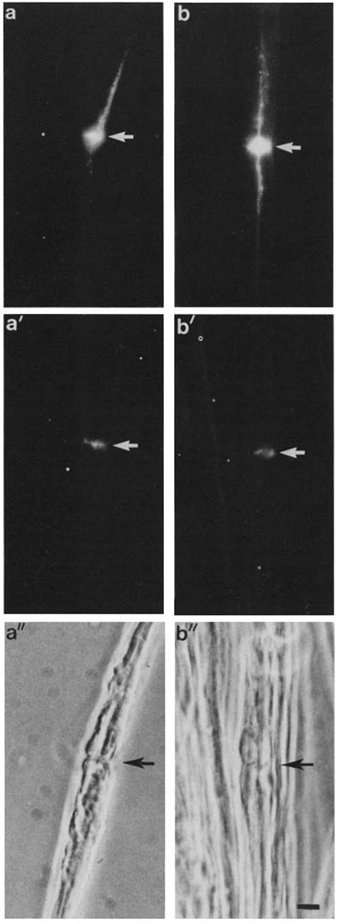 Longitudinal And Transverse Sections Of Adult Chicken Sciatic Nerves