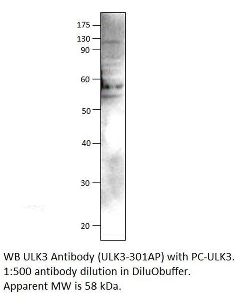 Ulk3 Polyclonal Antibody Ulk3 301ap