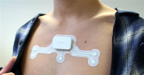 Wearable Device Detects Sleep Apnea Using Ai Can Help 97 Crore People Sleep In Peace