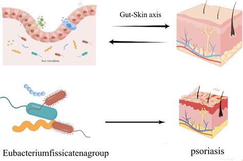 Figure 4 From The Causal Relationship Between Gut Microbiota And Immune Skin Diseases A