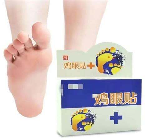 去除脚上的鸡眼用什么办法更好 腾讯新闻