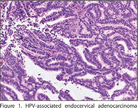 Endocervix Histology