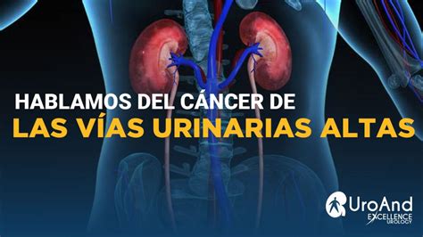 Hablamos Del Cáncer De Las Vías Urinarias Altas Excellence Urology