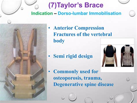 Splint Ppt By Rupeshkumar Pptx Splint Ppt By Rupeshkumar Pptx