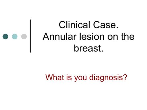 Annular Lesion On The Breast Ppt