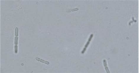 두배 많은 바이오연료 생산 미세조류 배양 성공