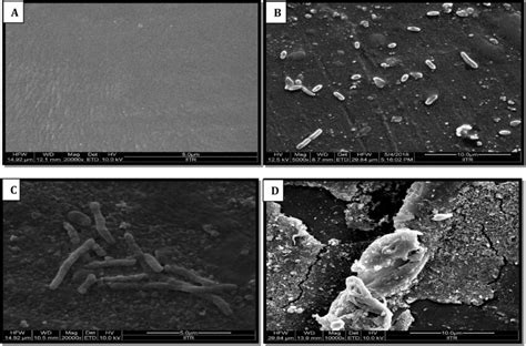Scanning Electron Microscope Sem Photographs Of Colonization And