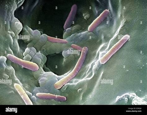 Scanning Electron Micrograph Sem Of Pseudomonas Aeruginosa Bacteria Also Known As Bacillus