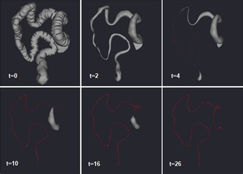 Skeletonization Progression At Different Time Instants Mcf Iterative Download Scientific