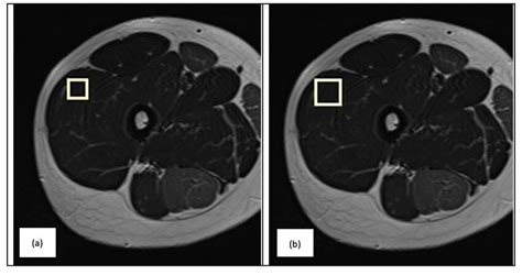 Size And Location Of The Voxel A A Mri T2 Weighted Image With Voxel Download Scientific