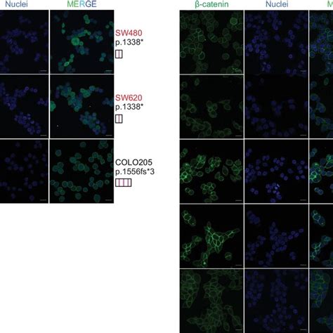Evaluation Of β Catenin Localization In Crc Cell Lines With And Without