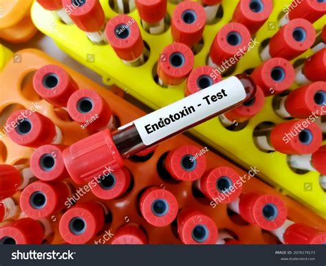 6 张 Bacterial Endotoxin Testing 免版税图片、库存照片和图像 Shutterstock