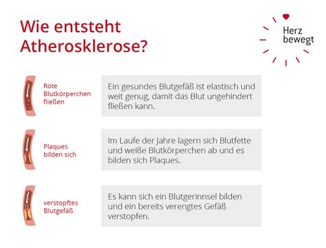 Was Ist Eigentlich Atherosklerose Herz Bewegt