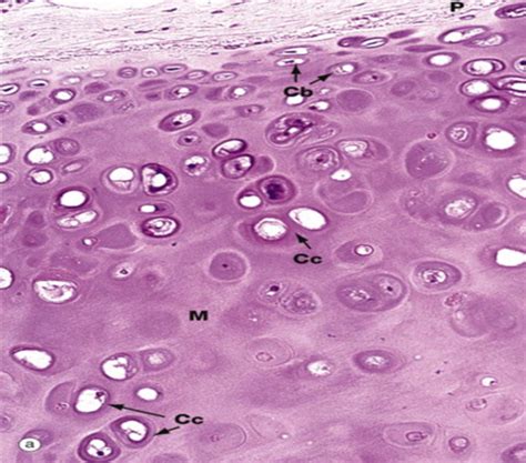 Bone Lesions Flashcards Quizlet