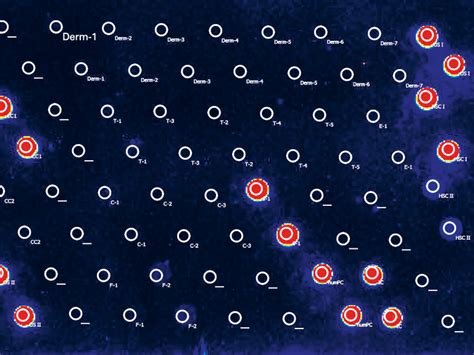 Microarray Diagnostics