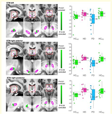 Within The Entire Sensorimotor Functional Network Shown In Fig 1
