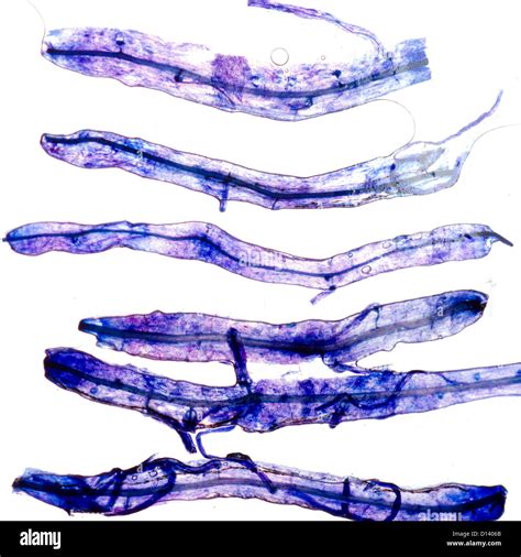 Fungus Microscope Hi Res Stock Photography And Images Alamy
