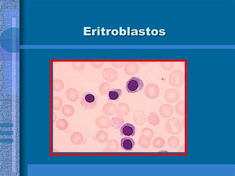 Ppt Eritroblasto Powerpoint Presentation Free Download Id5131399