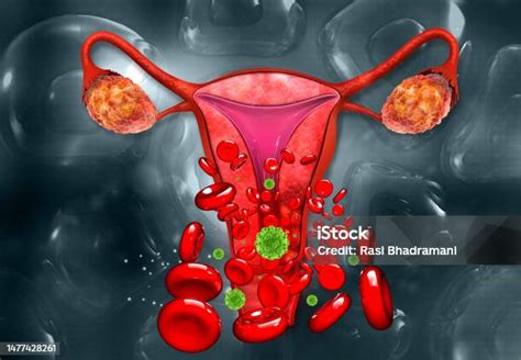 Anatomi Rahim Infeksi Rahim Foto Stok Unduh Gambar Sekarang