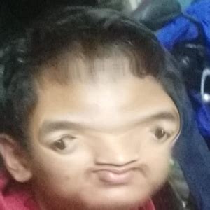 Twitch